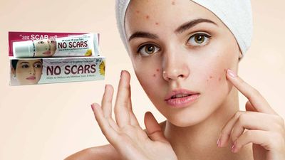 The Aspects Associated With The No Marks Cream | Wrytin