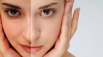 How To Get Rid Of Skin Tan Naturally | Wrytin